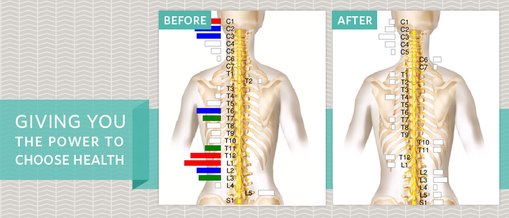Neuro Thermal Scans - Whole Family Chiropractic - Dr. Tye Moe - Dr ...