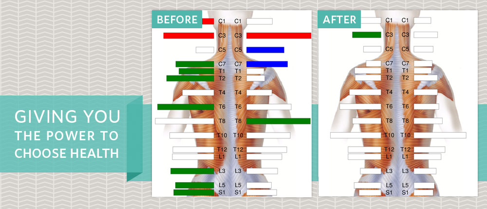 Neuro Spinal EMG Scans - Whole Family Chiropractic - Dr. Tye Moe - Dr ...